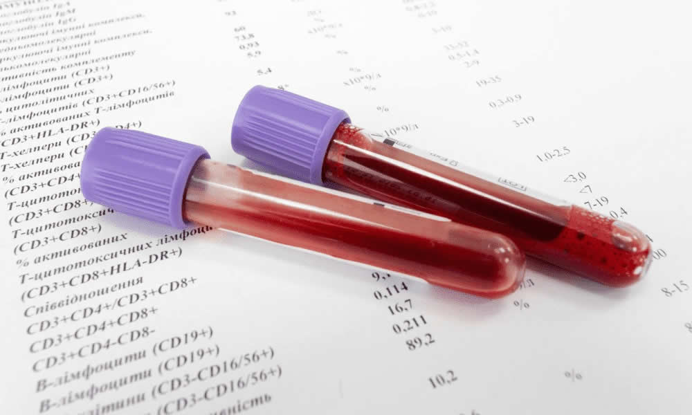 AMH Testi Nedir, Ne Zaman Yapılır? - Dr. Halil İbrahim Tekin